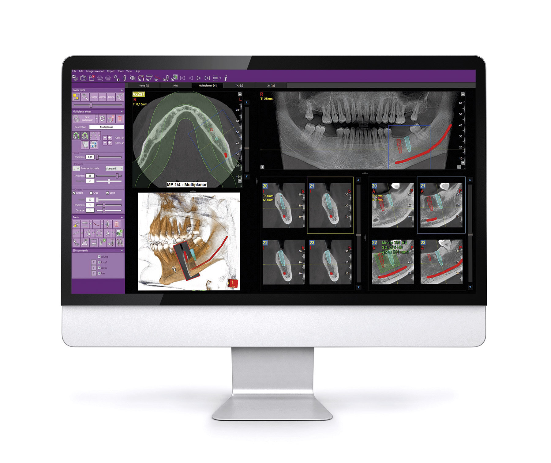 iRYS: Software für zahnärztliche Radiologie | Castellini